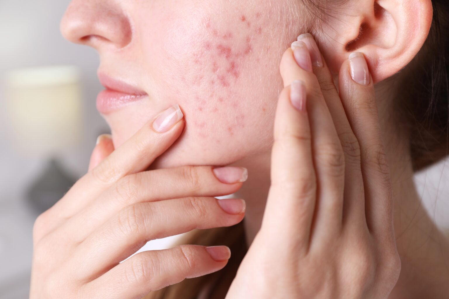 The Gut-Skin Axis: What Your Digestive System Is Telling Your Skin ...
